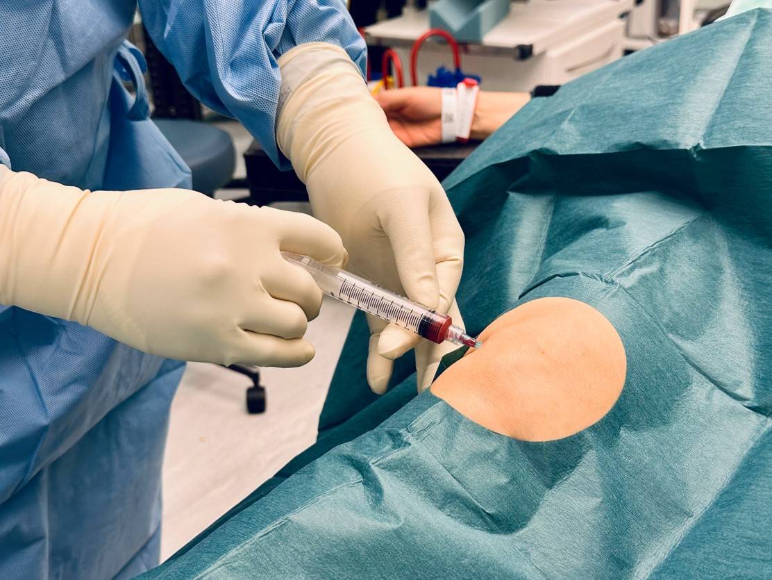 New Injection Treatment for Knee Joint Degeneration: Autologous Protein Solution (APS) Injection ...